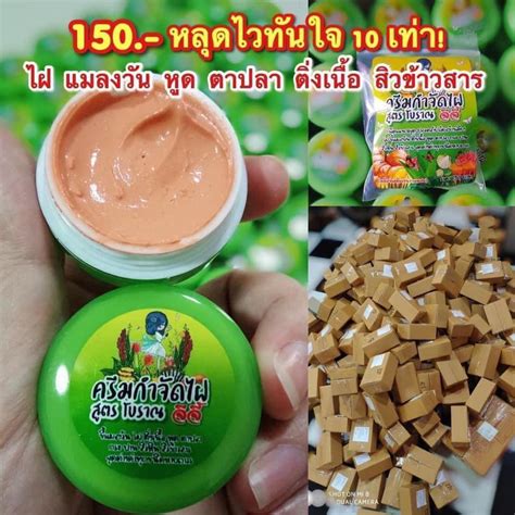 ครีมกำจัดไฝ ขี้แมลงวัน ติ่งเนื้อ หูด ตาปลา กระ จุดด่างดำทุกชนิดหายถาวร