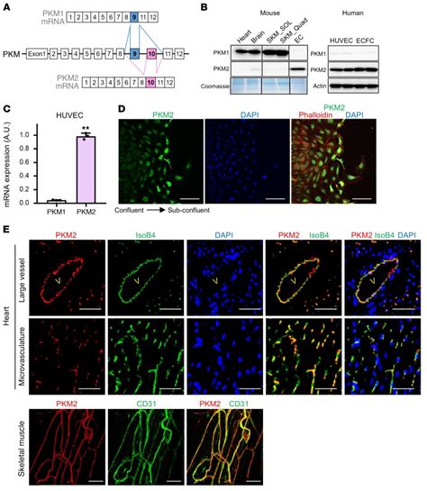 Endothelial Pyruvate Kinase M2 Maintains Vascular Integrity Pmc