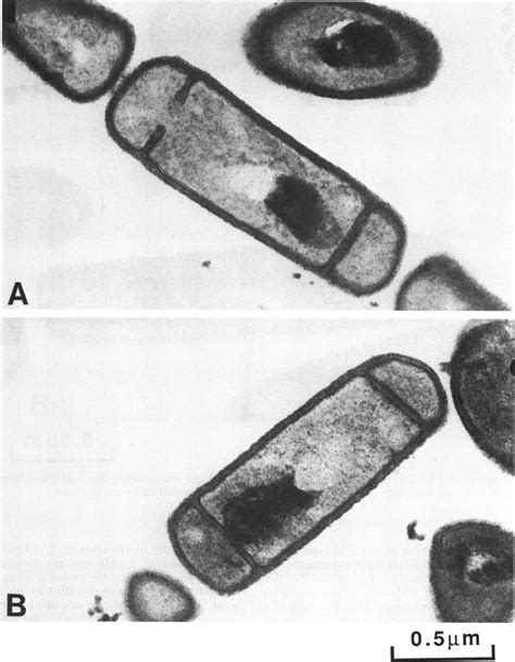 Electron Micrographs Of The Sporulation Septa In B Subtilis Strains