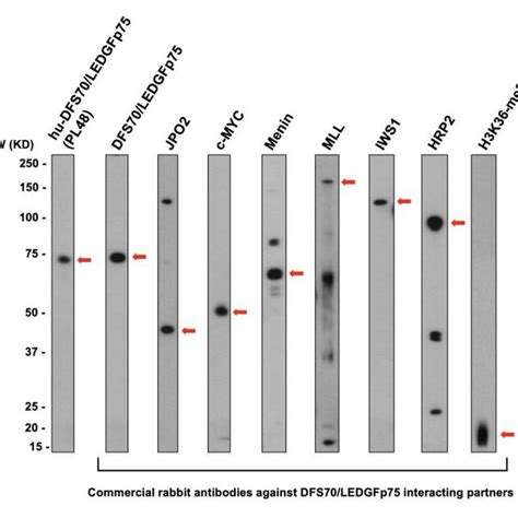 Immunofluorescence Antibody Patterns Of Selected Dfs70ledgfp75