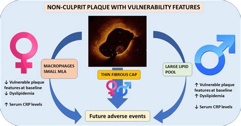 Different Prognostic Impact Of Oct Detected Vulnerable Plaque Features