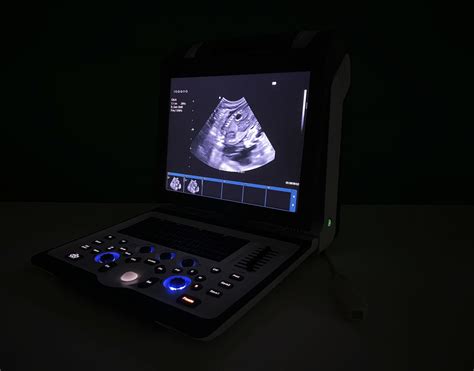 Ex Demo Apogee 2300 Portable Ultrasound Machines