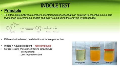 Enterobacter Aerogenes Indole Test
