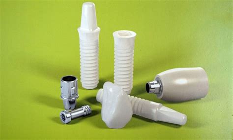 Bio Implants Market Analysis And Forecast For Next 5 Years Newstrail