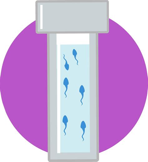 Sperm Analysis Count For Ivf Procedure Conceptual Illustration Of The Mciroscope And Sperm Cells