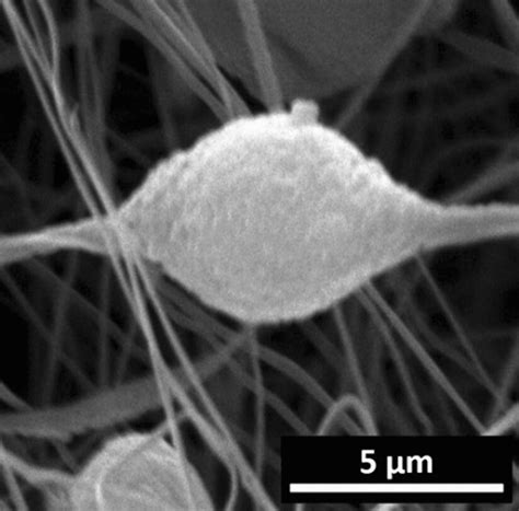 Sem Micrograph Of The Nano Spindle Structure Download Scientific Diagram