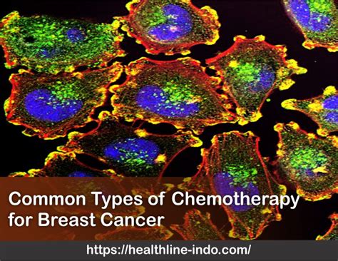 Types Of Breast Cancer Chemotherapy At Harlan Rockwood Blog
