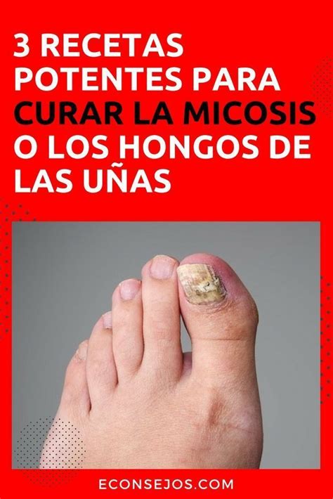 Cómo Mejorar La Circulación Para Aliviar El Dolor Del Talón