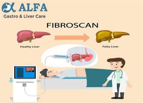Understanding The Fibroscan Test A Non Invasive Assessment Of Liver