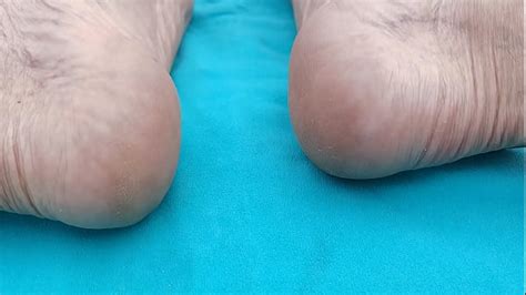 Close Up Of My Feetand Soles And Heelsand Sunbathing By The River Xxx