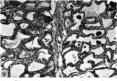 Figure 2 From Histopathology Of Bovine Mastitis The Semantic Scholar