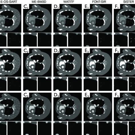 Simulated Moby Data Reconstruction Results Of Different Methods Under Download Scientific