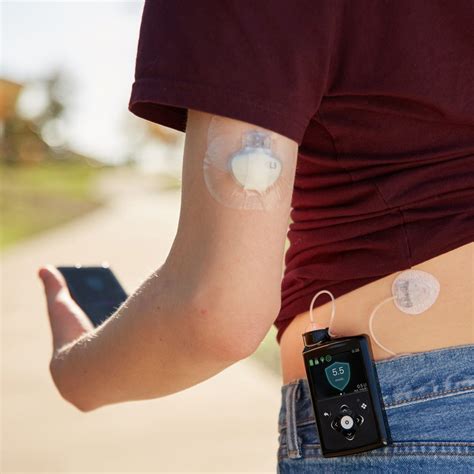 Minimed 780g Mediq Direkt Diabetes