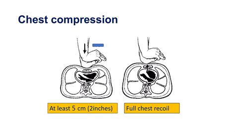 Advanced Cardiovascular Life Support Acls Pptx