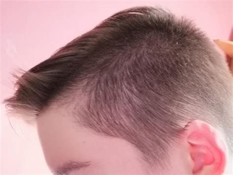 Is My Hair Thinning On The Left Side Of My Head Rhairloss