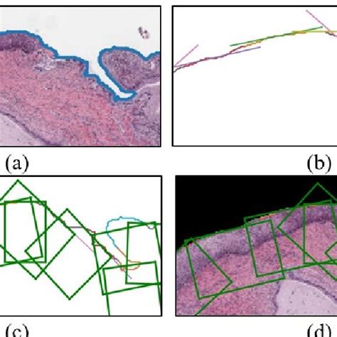 Cin Classification Results On Ou16 Set Download Scientific Diagram