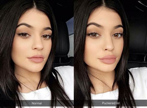 Kylie Jenners Lip Filler Isnt The Only Secret To Her Famously Plump