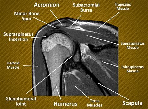Impingement Syndrome Back In Action
