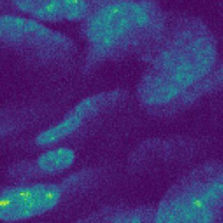 Qualitative Denoising Results We Compare The Performance Of Our Method Download Scientific