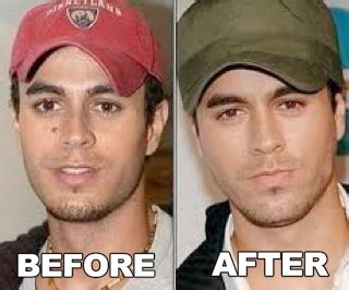 Enrique Iglesias Cosmetic Surgery Nose Job Before And After Pictures