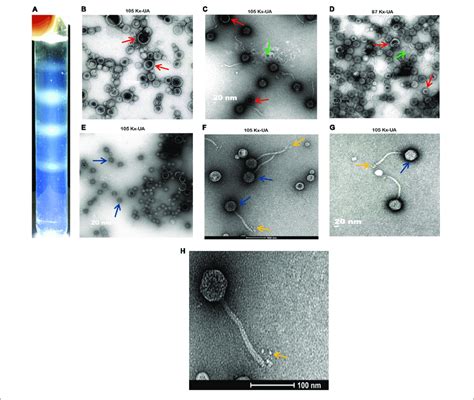 A Comparison Between Two Density Gradient Media And Electron Download Scientific Diagram