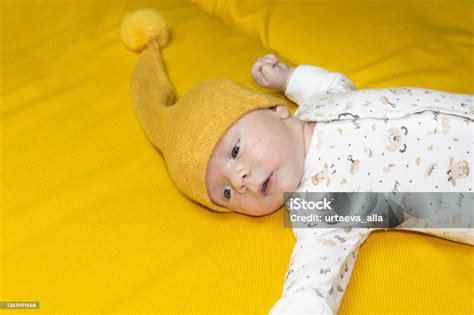 노란색과 회색 배경에 여드름과 여드름을 가진 신생아 신생아와 라이프 스타일의 사진 촬영 습진 및 아토피 성 피부염 0 11