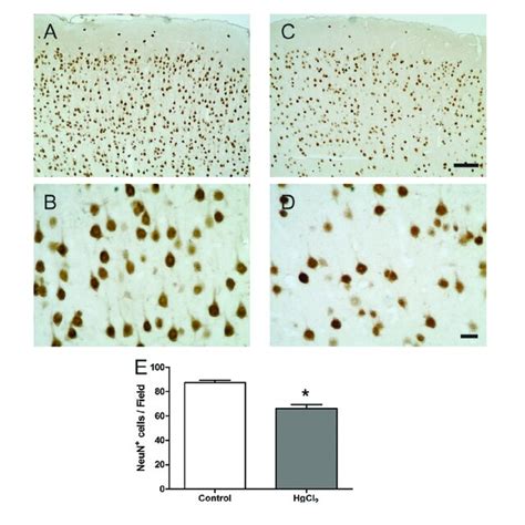 Effects Of Chronic Exposure To Hgcl 2 On Neuronal Density In The