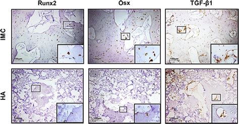 Immunohistochemical Staining Of Runx2 Osx And Tgf β1 In The Defect Download Scientific