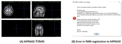Adni数据预处理 Dcm2nii批量处理adni Dcm转nii Csdn博客