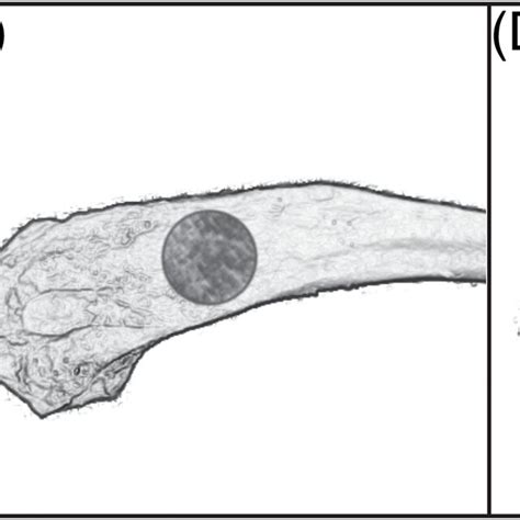 A Bone Defect In Medial Face Of Tibia B Techgraft Membrane Of