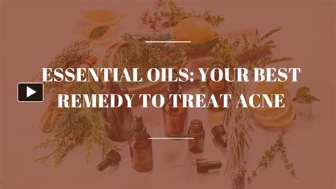 PPT Essential Oils Is Your Best Remedy To Treat Acne PowerPoint