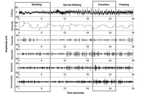 Decomposition Of Eeg Into Detail D1 D5 Signals Related To Five Download Scientific Diagram