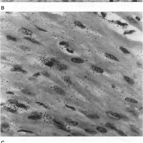 In Situ Hybridization For Igf 11 Mrna Illustrating That The Signal Download Scientific Diagram