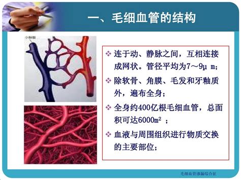 毛细血管渗漏综合征 word文档在线阅读与下载 无忧文档