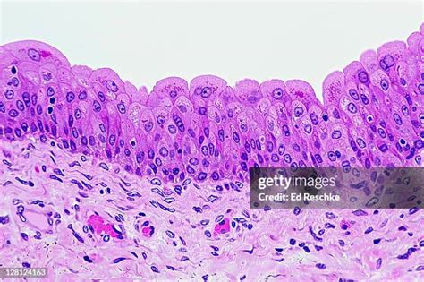 Transitional Epithelium Tissue