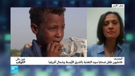 اليونيسف 16 مليون طفل ضحايا سوء التغذية بالشرق الأوسط وشمال أفريقيا