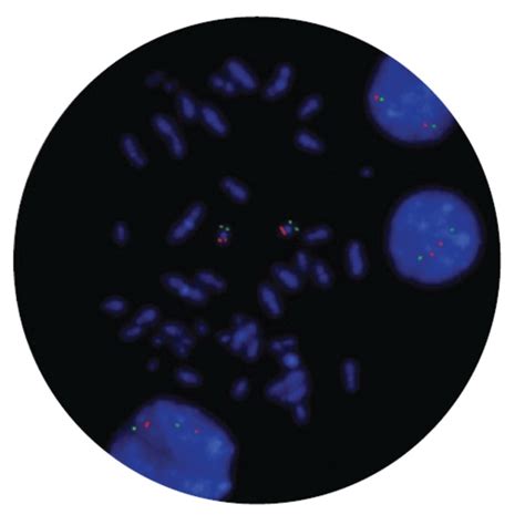 CytoCell CBFß MYH Translocation FISH Probe FDA cleared OGT