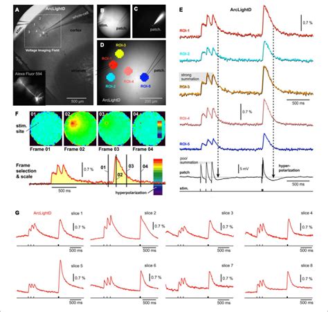 Single Cell Intracellular Recording And Population Voltage Imaging Download Scientific