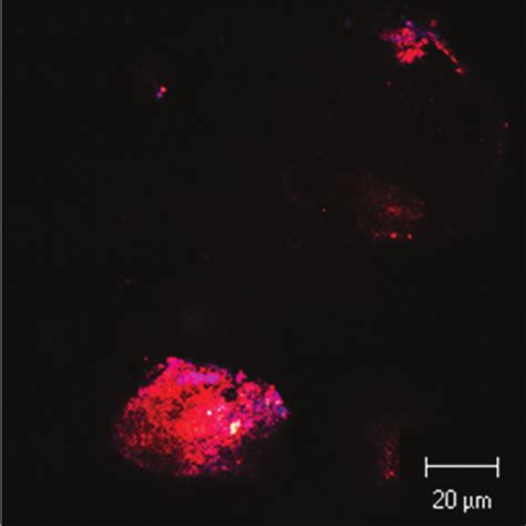 Composite Sclm Micrograph Showing Multiple Lectin Conjugates For A