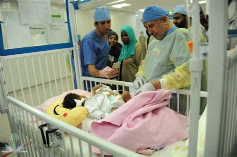 فصل التوأم السيامي التنزاني جريدة بكره أحلى الاخبارية