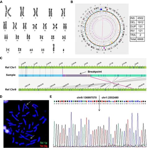 Optical Genome Mapping A Beacon Of Hope For Understanding Recurrent