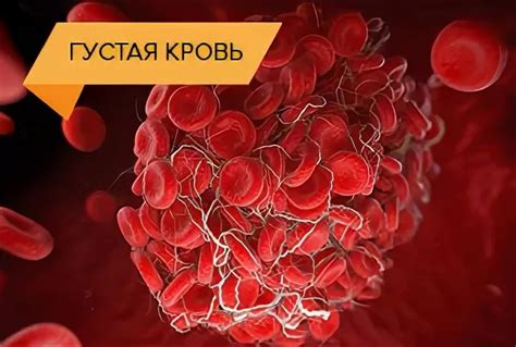 Definition Of Dense Blood The Condition Of Blood Thickening Has A