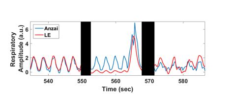 6 Three Projections Of A Respiratory Surrogate Derived From A Lung