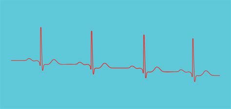 Ventricular Repolarization Cardiac Cycle Ecg Of Heart In Normal Sinus
