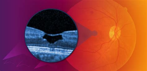 Back To The Basics Understanding Methods For Measuring Visual Acuity Optometry Times