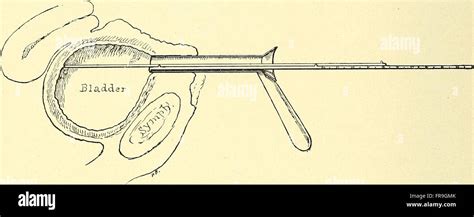This 1906 Work On Operative Gynecology Explores Surgical Methods For