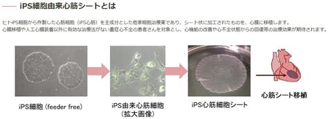 クオリプスipoの上場承認！ipo基礎情報と初値予想！ Ipoで勝つ株式投資