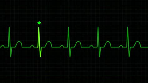 Electrocardiogram ECG EKG Traces Unity Engine Unity Discussions