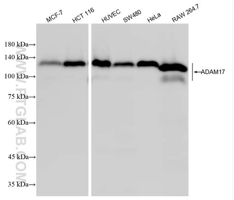 Adam17 Antibody 84292 4 Rr Proteintech
