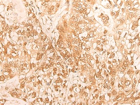 兔抗dbp多克隆抗体anti Dbp Rabbit Polyclonal Antibody 生命科学产品与技术服务 生工生物工程上海股份有限公司